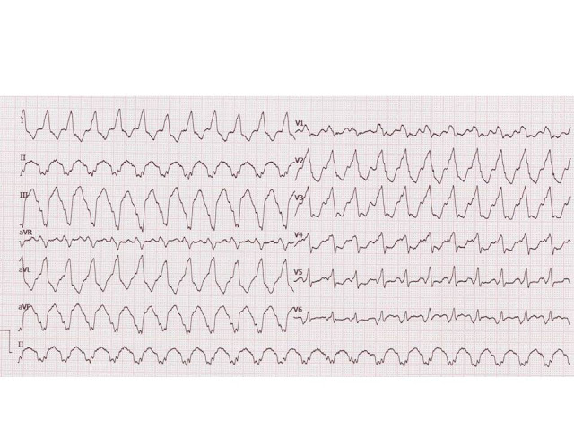 News Klinische Notfall- und Akutmedizin: Fancy EKG - Patient mit Unwohlsein