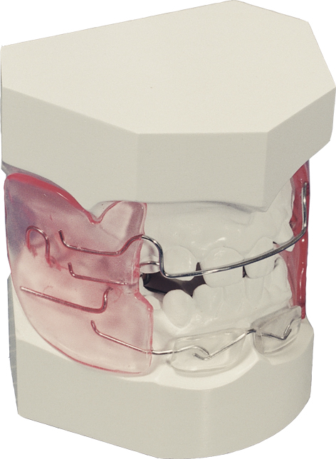 Dentistry and Medicine: Functional appliances-Orthodontic Lecture note