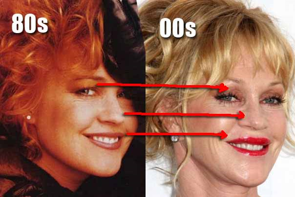 Melanie Griffith Plastic Surgery Before and After Botox and Facelift ...