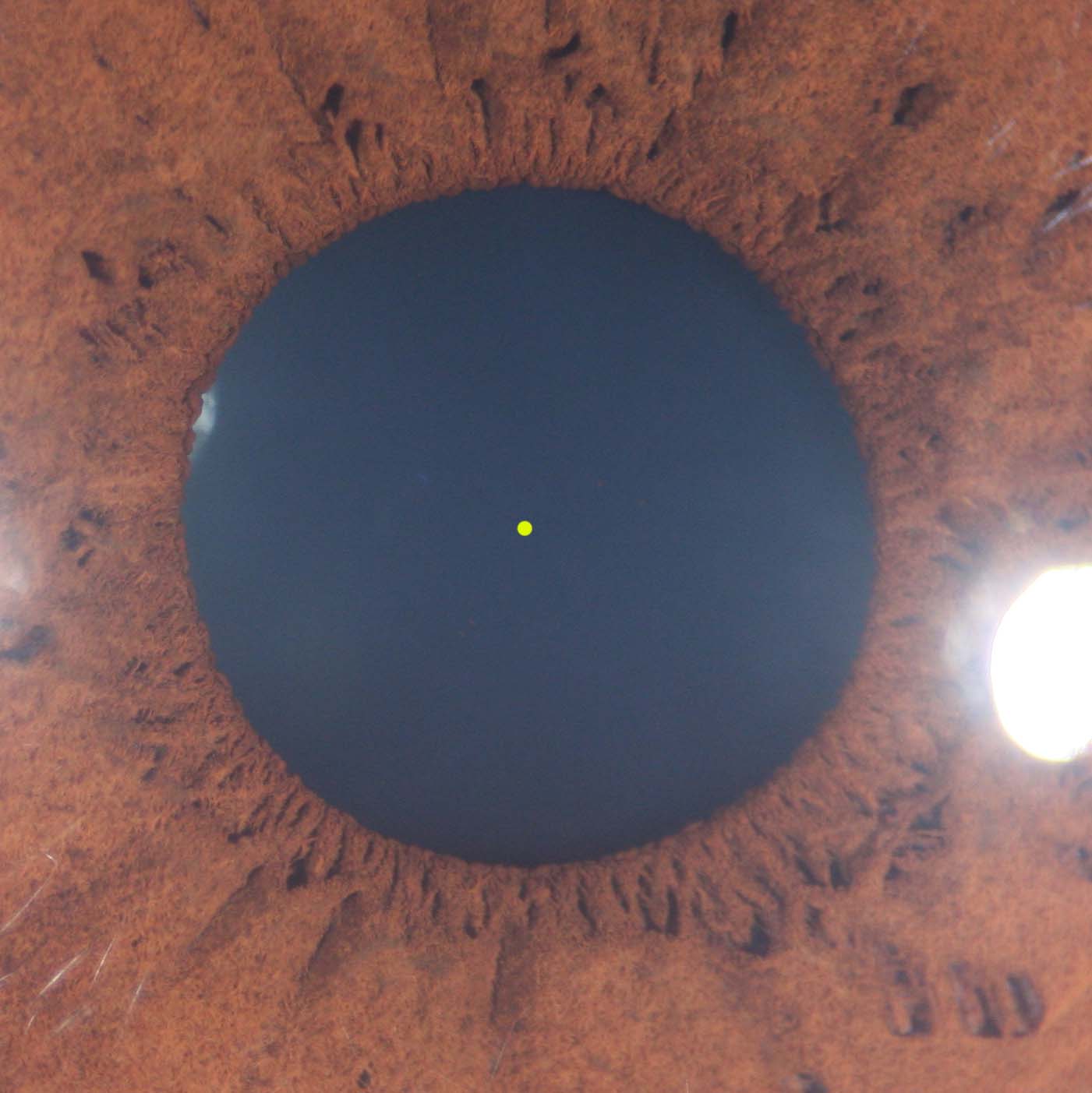 Modern & Multidimensional Iridology: An Importance Iris Signs ! - Lx ...