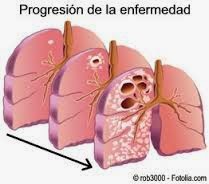 PatologiaB2014 Castillo