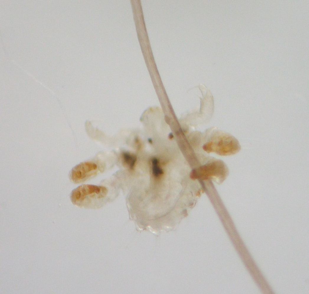 BLOG: Microbiología para Técnicos/as: Nematelmintos