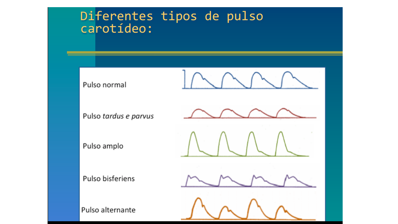 Pulso Parvus Et Tardus - RETOEDU