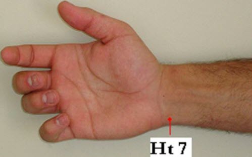 Acupuncture may reduce high blood pressure - Tools and instructions ...