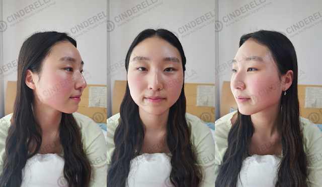 Cinderella Plastic Surgery