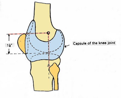 Skeletal Traction: Common sites