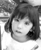 Enfermedades raras: Síndrome de Moebius