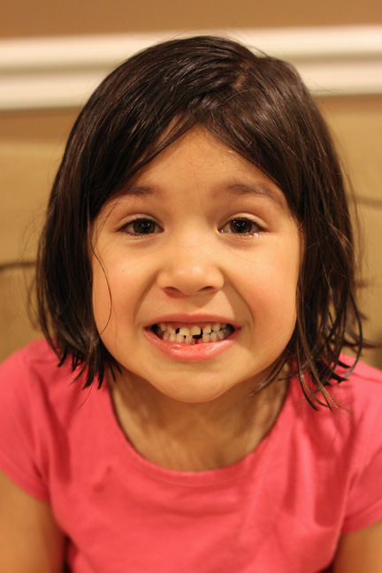 Life on Cedar Ridge: Ava loses a tooth...or two...
