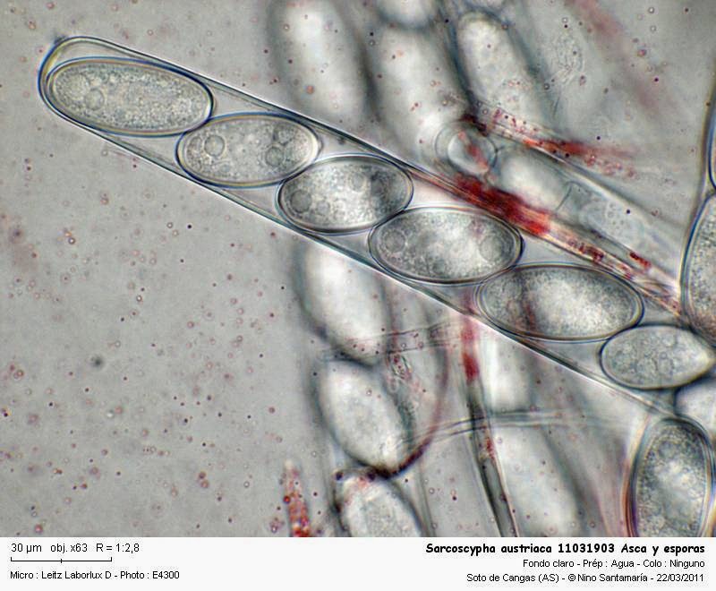 Fly Shadows.: Accidente en el género Sarcoscypha.