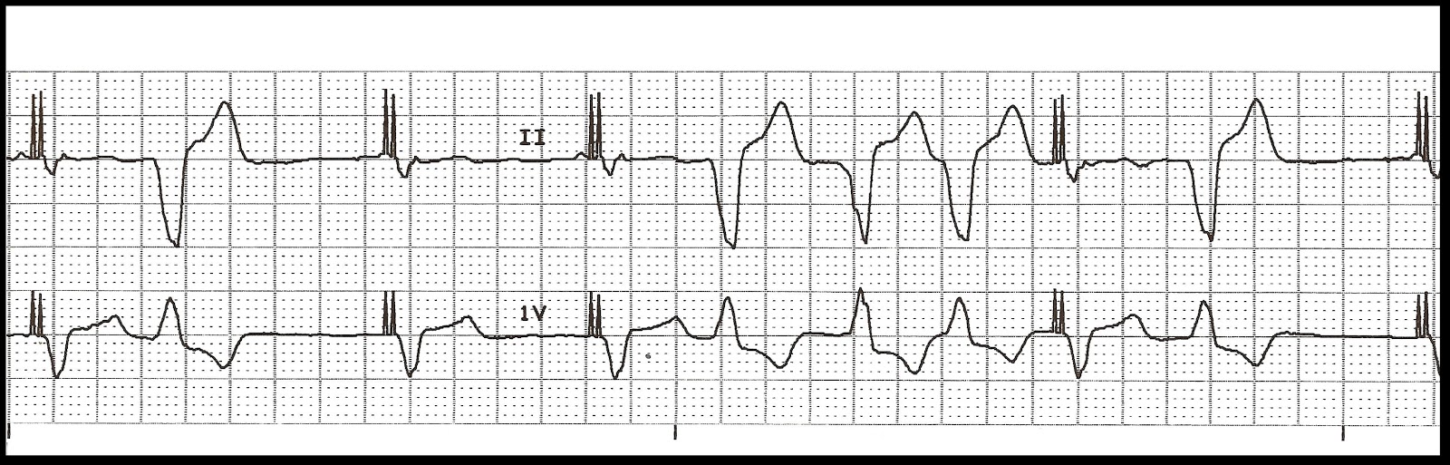 EKG Quiz 325
