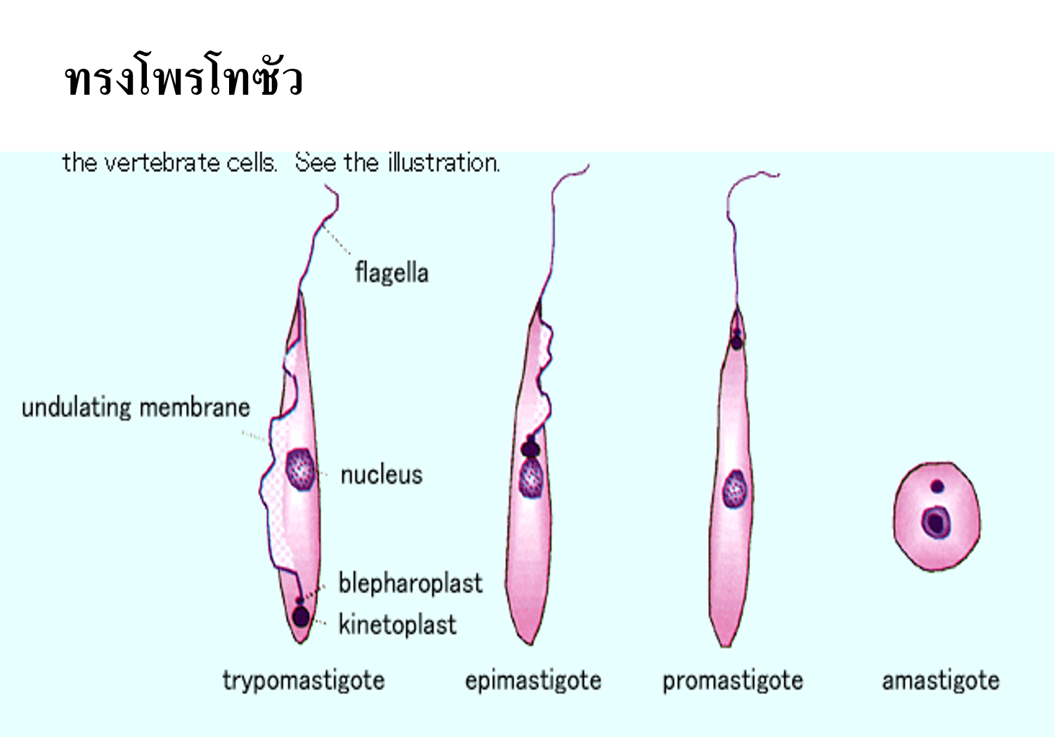 Trypanosoma brucei gambiense (rhodesiense)