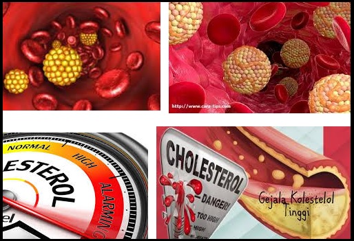 Seputar Bidan: Artikel Kolesterol
