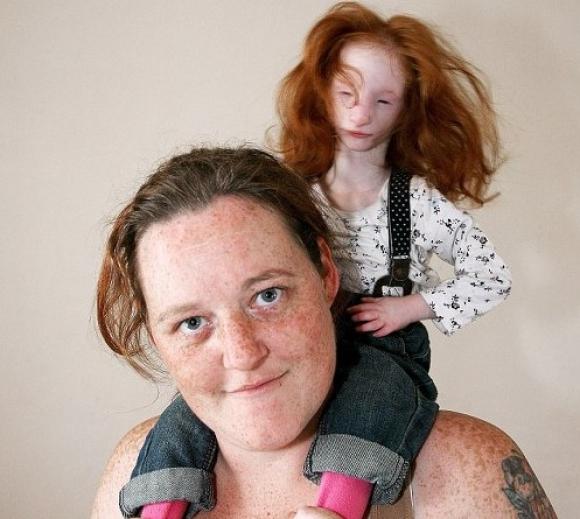 Charlotte Garside la niña más pequeña del mundo ya va a la escuela