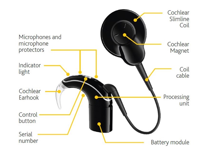 Prime Clinic: Cochlear Implants & BAHA