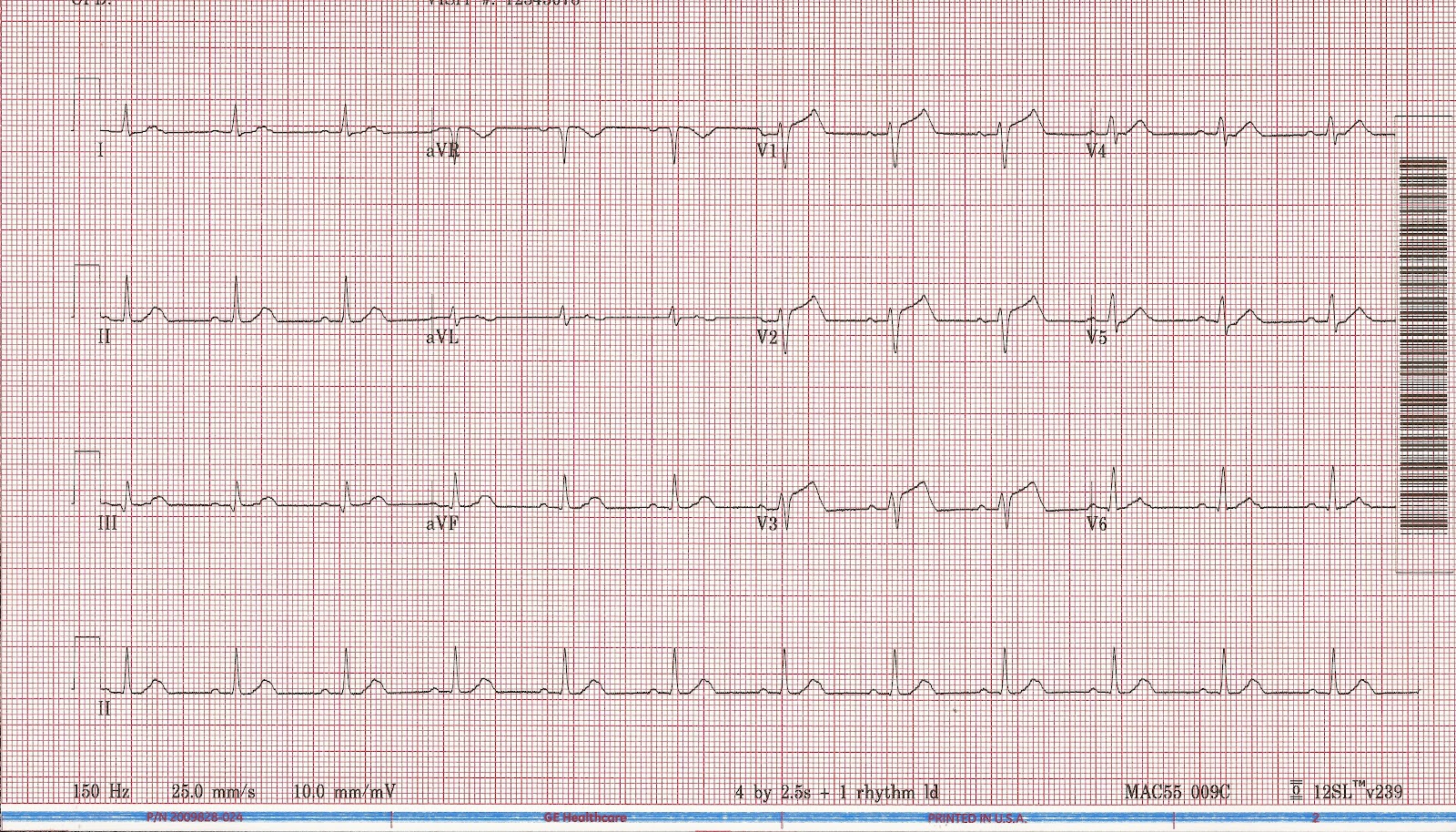 Megacode: Unstable Ventricular Tachycardia Part 6
