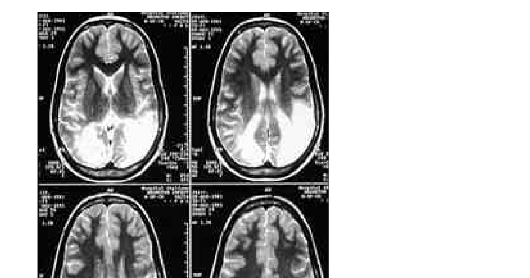 PSICOLOGÍA: Imágenes reales de cerebros