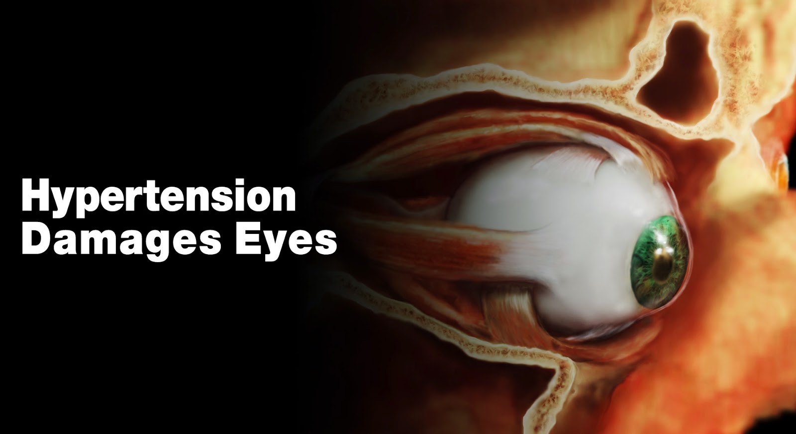 Health and Wellness: Altapresyon (Hypertension)