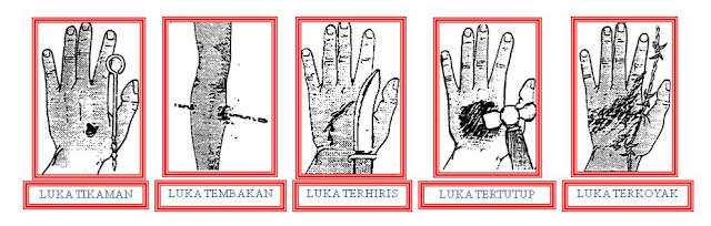 FIRST AID : LUKA ( WOUND ) ( BASIC )