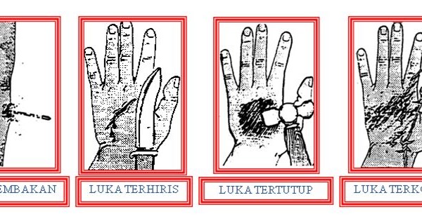 FIRST AID : LUKA ( WOUND ) ( BASIC )