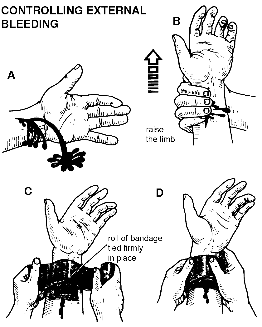First Aid - Basic Firs Aid