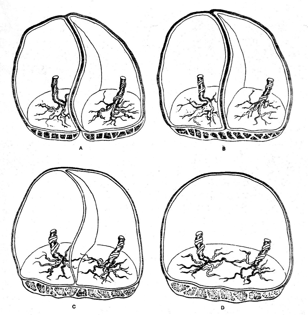 BIDANKU KEREN: KEHAMILAN KEMBAR ( GEMELLI )