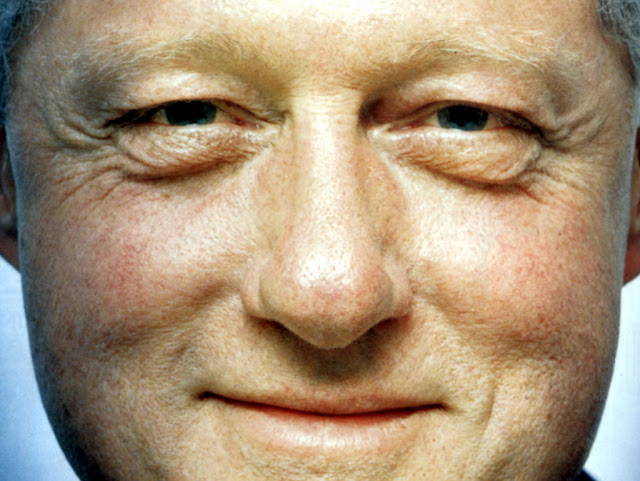 My Rosy Rosacea