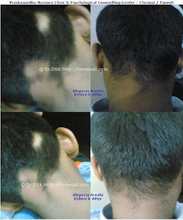 Dr.Senthil Kumar Homeopathy Clinic - Velachery - Panruti - Chennai ...