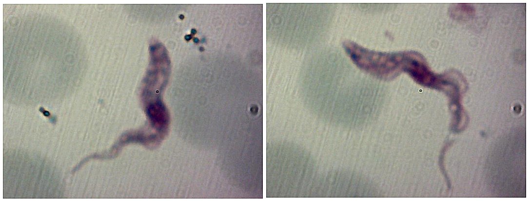 A Dull Day At Work...?: 5 November 2011 (Saturday) - Trypanosomiasis