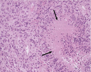 NEKROSIS - Iswary Halwadini