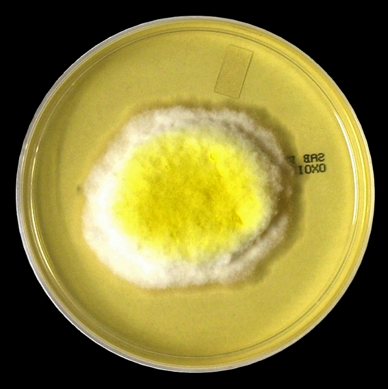 Fun With Microbiology (What's Buggin' You?): Sepedonium species