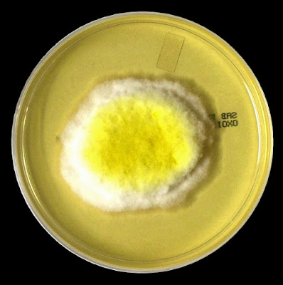 Fun With Microbiology (What's Buggin' You?): Sepedonium species