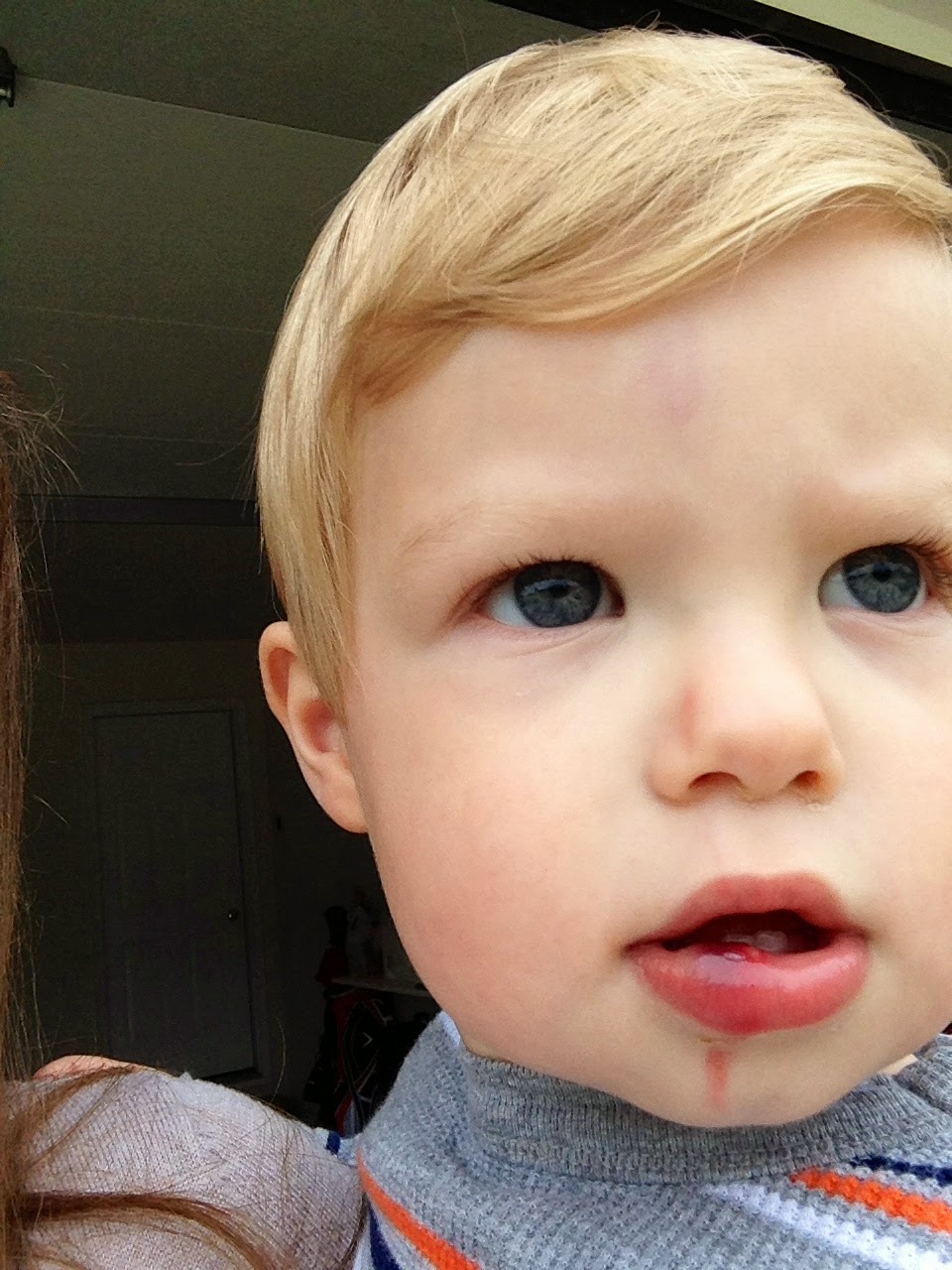 Baby on Board!: My First Major Boo-Boo!