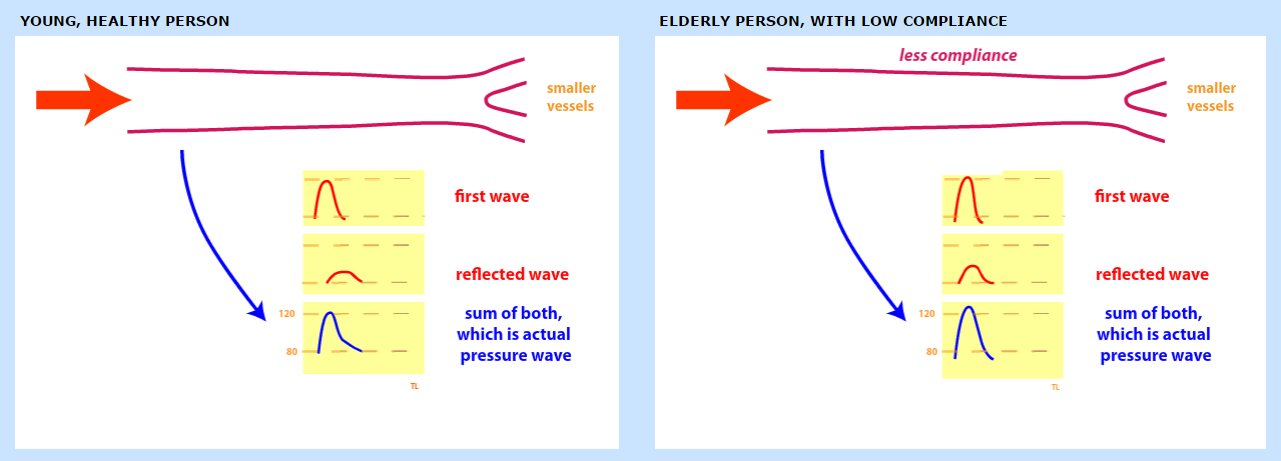 Armlocks and Emergency: Pulse pressure and atherosclerosis