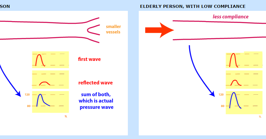 Armlocks and Emergency: Pulse pressure and atherosclerosis