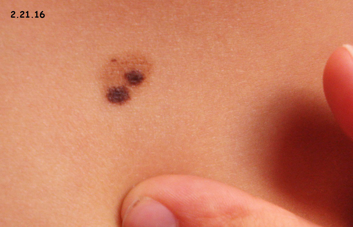 VIRTUAL GRAND ROUNDS IN DERMATOLOGY 2.0: A Thing of Beauty