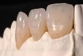 A.d. Couronne Jacket