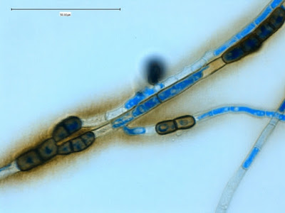 Fun With Microbiology (What's Buggin' You?): Pithomyces species