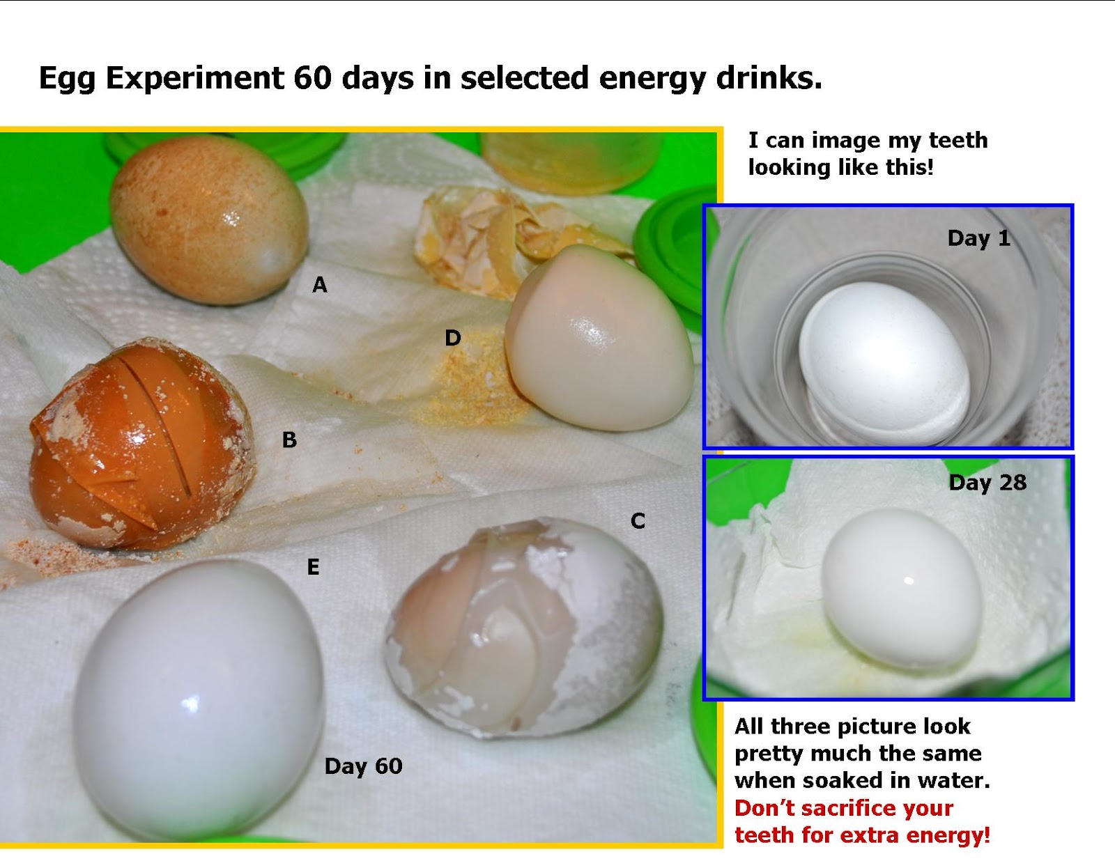 Promoting Healthy Teeth & Gums