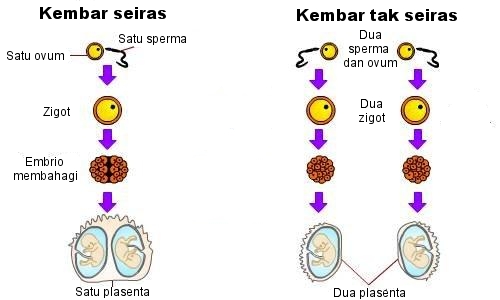 My Share Learning Content: 3.3 Penentuan Jantina Anak dan Kejadia Anak ...