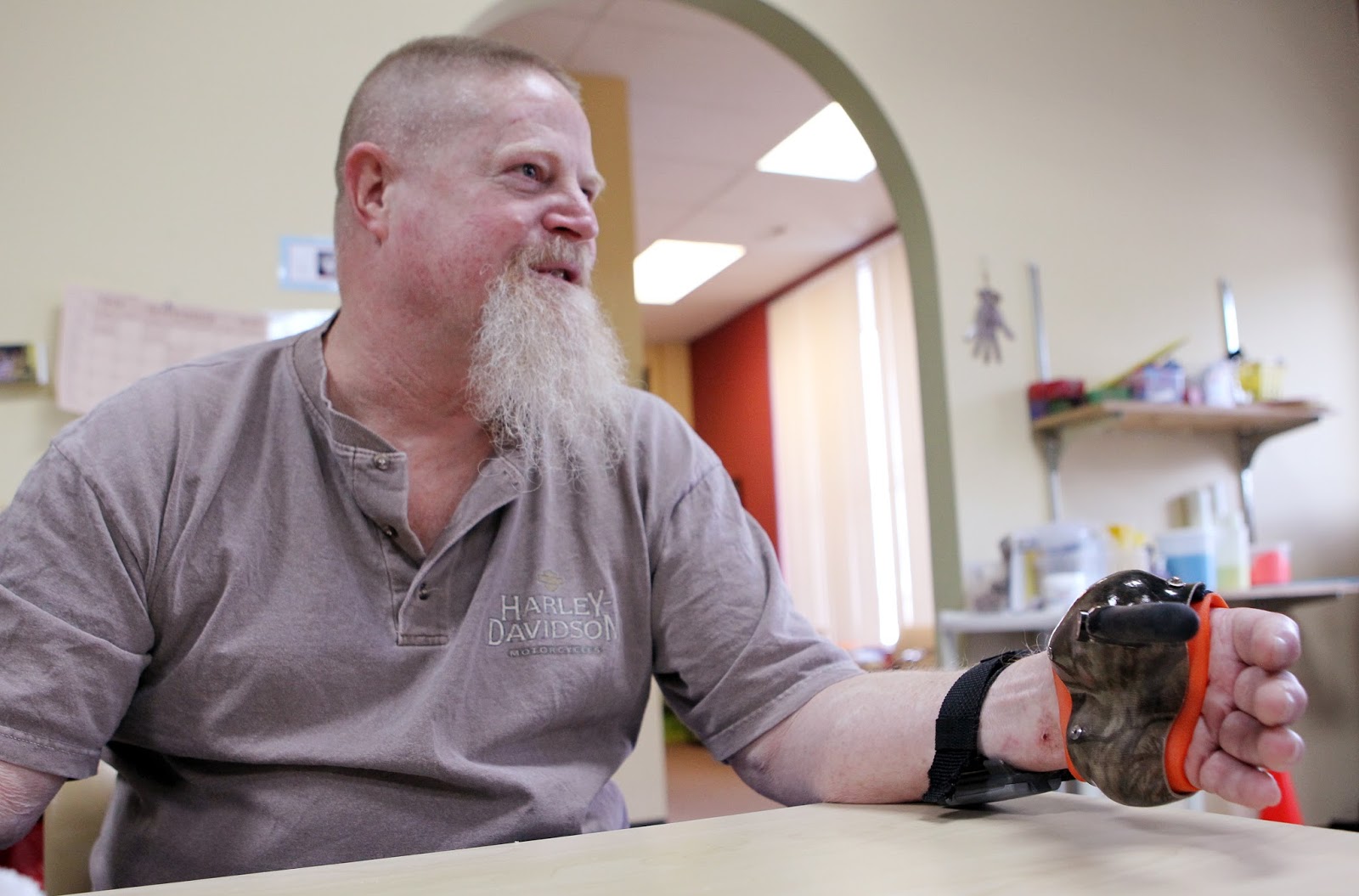 Mark Kodiak Ukena: Adam Pringle and his Bionic Thumb at Dynamic Hand ...