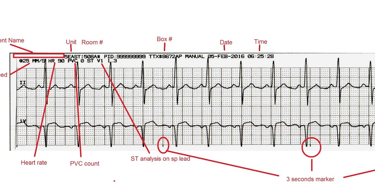 ECG Rhythms: Mastering ECG interpretation in Telemetry Units # 1