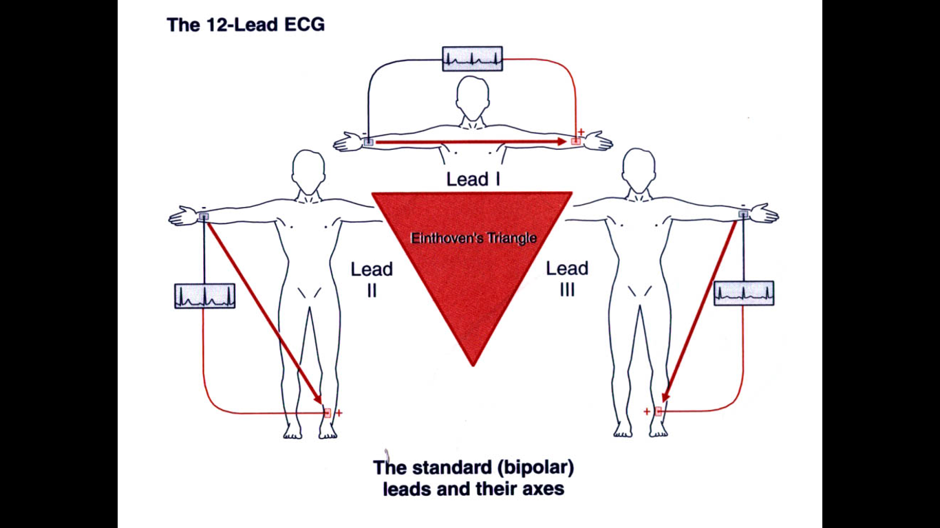 SAYANGI JANTUNG KITA: SADAPAN ECG, EKG