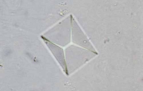 Atlas of Crystals found in alkaline urine | Free Medical Atlas