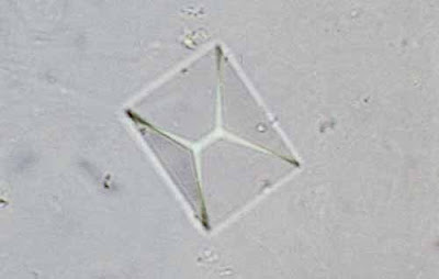 Atlas of Crystals found in alkaline urine | Free Medical Atlas