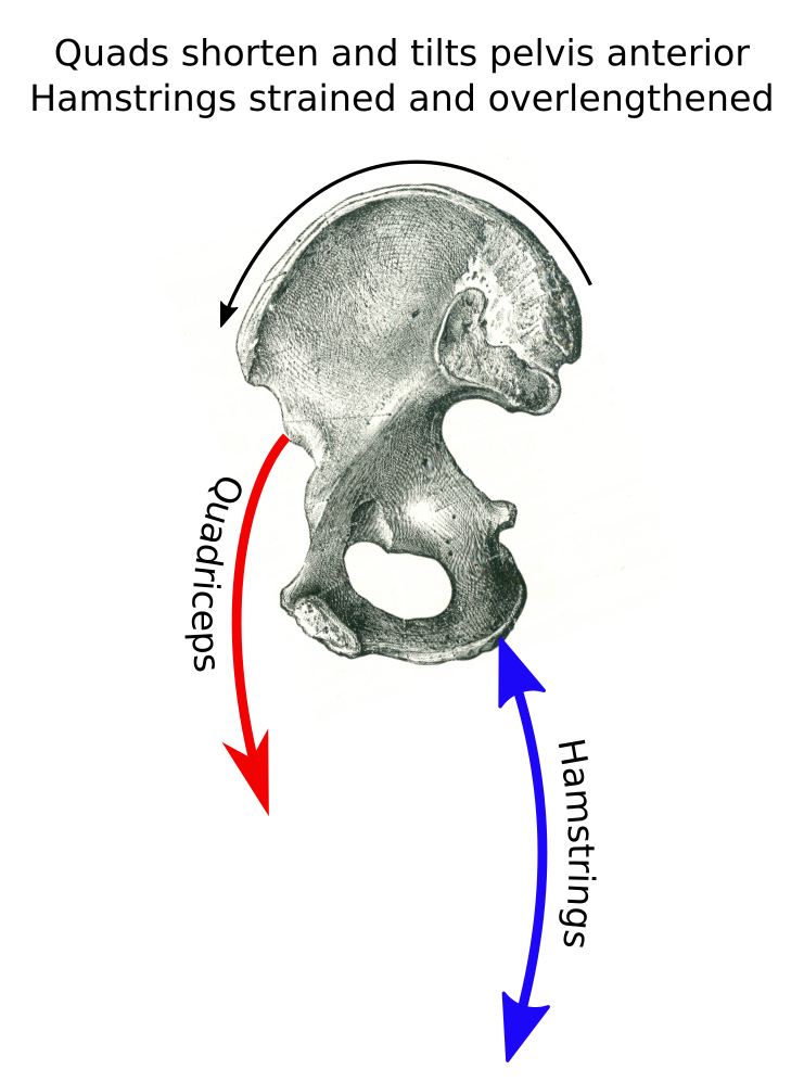 Ideal Balance Acupuncture: High Hamstring Tendinopathy