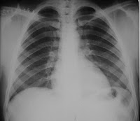 anatomia basica en imagenologia: El Torax