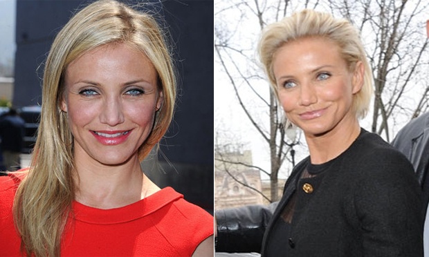 Quinta-Feira 12: Famosas que colocaram botox - veja o antes e depois