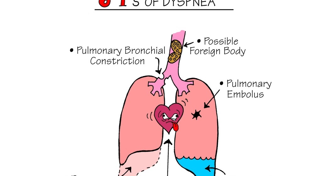 6p s of Dyspnoea