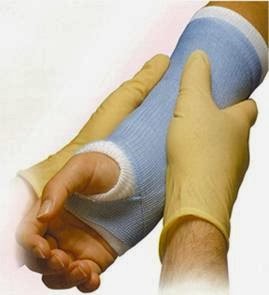 傷口大師: Off-loading 減壓-Scotchcast boot樹脂石膏鞋