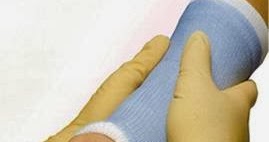 傷口大師: Off-loading 減壓-Scotchcast boot樹脂石膏鞋